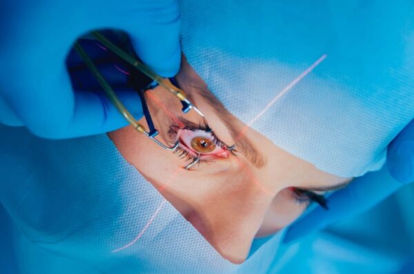 LASIK Pre Operative Procedure - Sanjivani Eyes Hospital